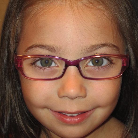What We Treat - Pediatric Ophthalmic Consultants